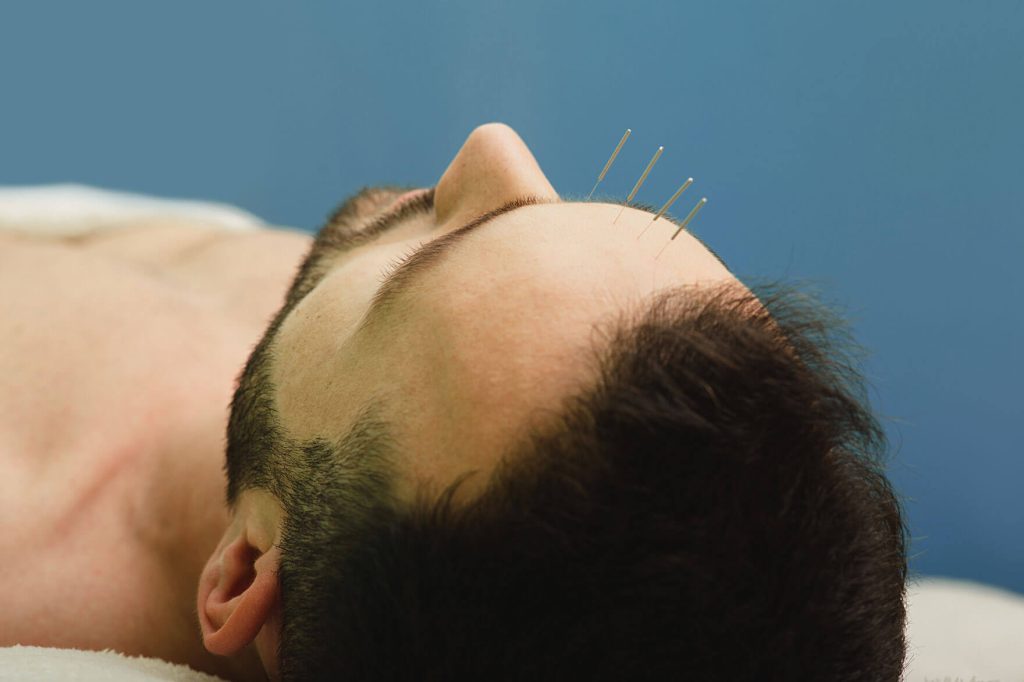 Acupuncture, a profession that has withstood the ages… | Back to Motion ...
